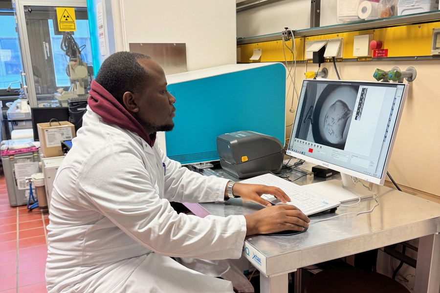 Schwere Verläufe verhindern: neue Antikörper gegen Hepatitis E: Universität zu Lübeck